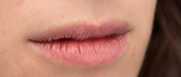 Best Ways to Treat Chapped Lips - Dermatology Physicians of Connecticut
